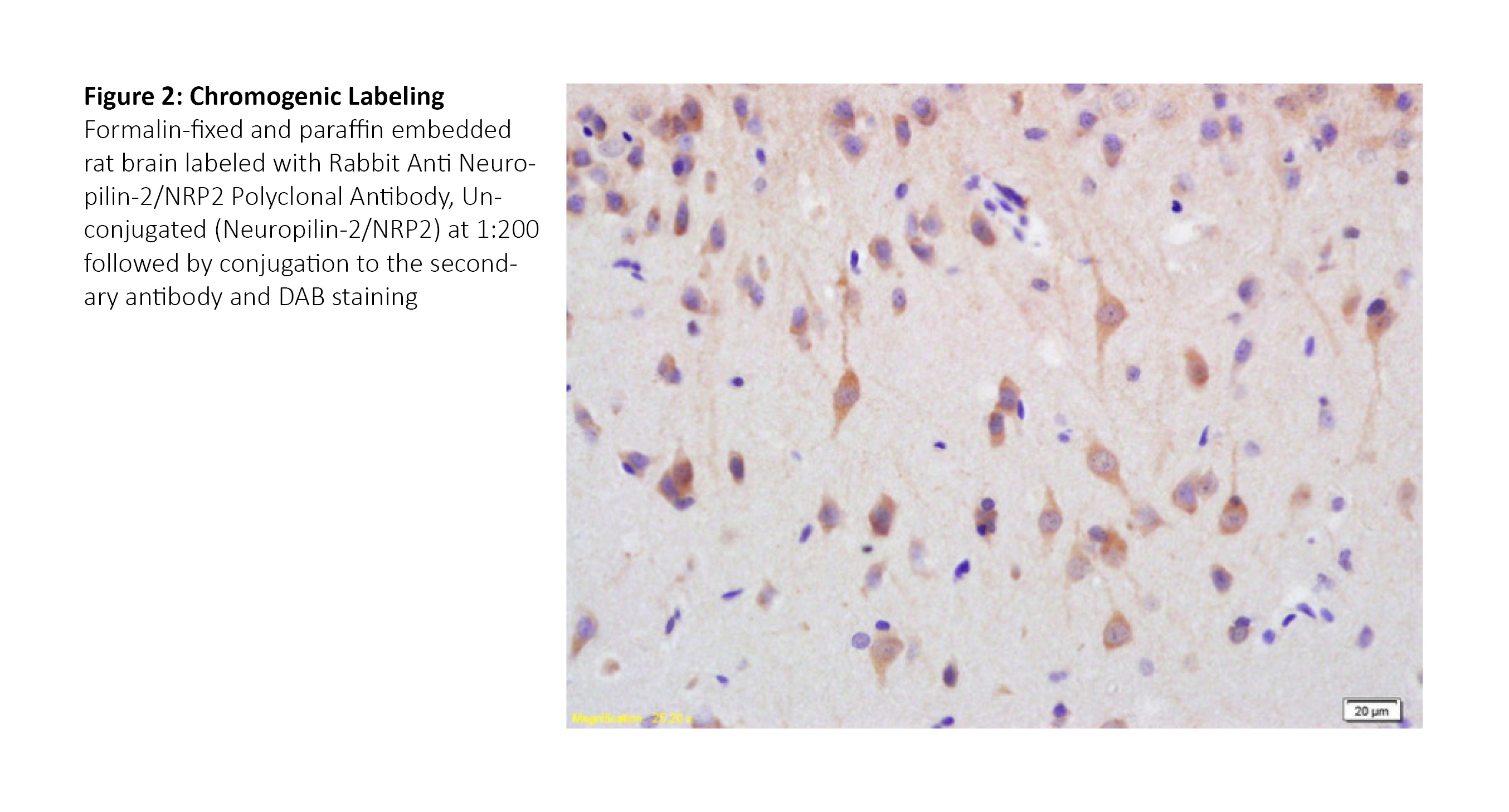 Fluorescent vs. Chromogenic Detection in Immunohistochemistry